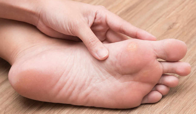 Kamu Perlu Tahu! Ini Dia Fakta Mata Ikan, Dari Penyebab Hingga Gejala!